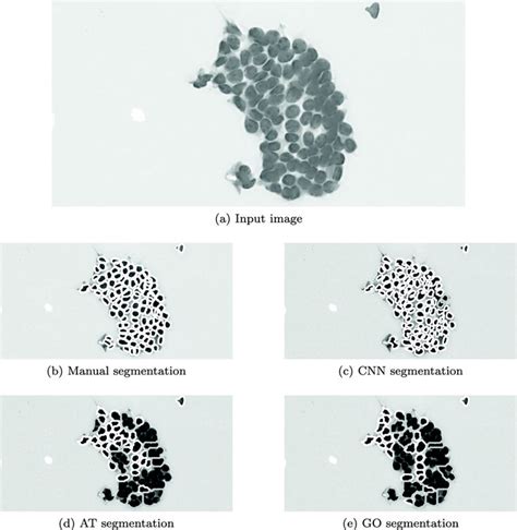 Cell Nuclei Segmentation In Cytological Images Using Convolutional