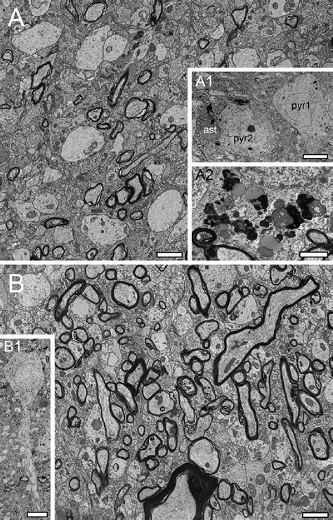 Neuronal Organization Of L6 In The Human Tln A Low Power Electron Download Scientific