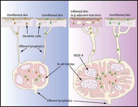 An Unexpected Connection Lymph Node Lymphangiogenesis And Dendritic