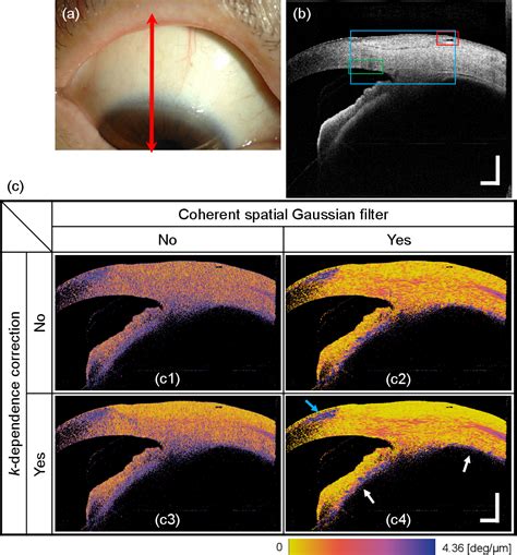 Figure 1 From Fiber Based Polarization Sensitive Oct For Birefringence