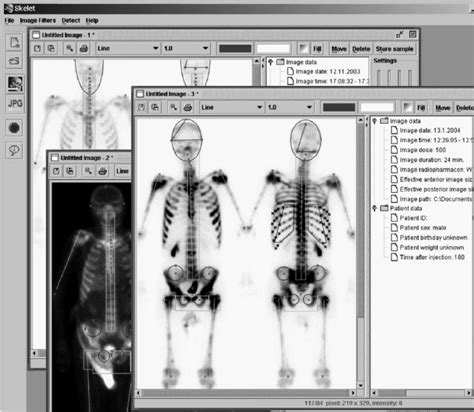 View Of The Program Skeleton Download Scientific Diagram