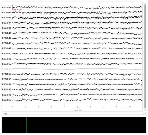 Setting The Eeg Reference — Mne 103 Documentation