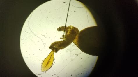 Parasitology Lab Exam 3 Flashcards Quizlet