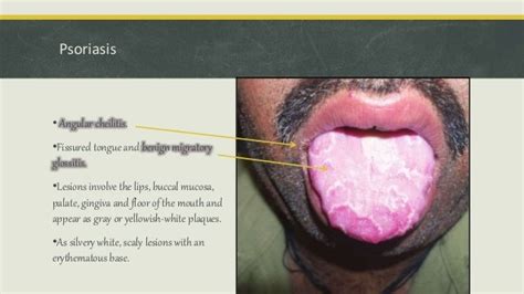 Oral Cavity Is The Mirror Image Of Body