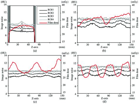 Figure A1 Roi2 Roi3 And Roi4 In 256 Slice Ct A Axial Scan Download Scientific Diagram