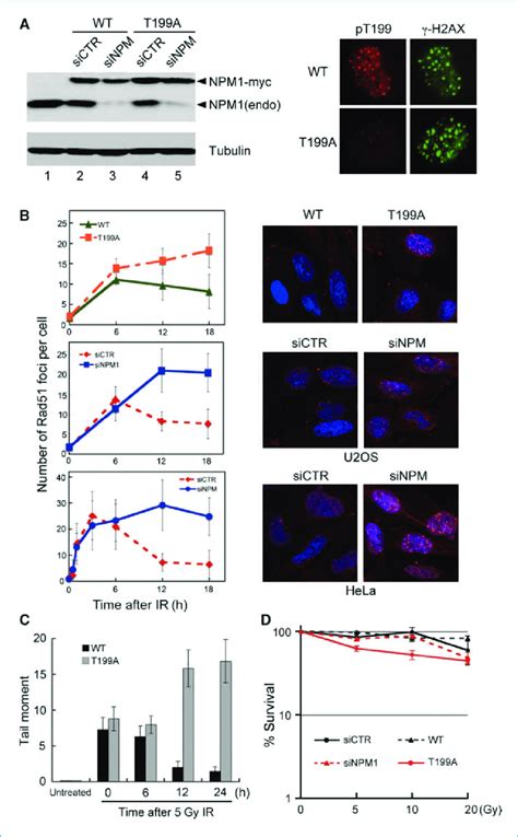 Depletion Of Pt199 Npm1 Prolongs The Persistence Of Rad51 Irif