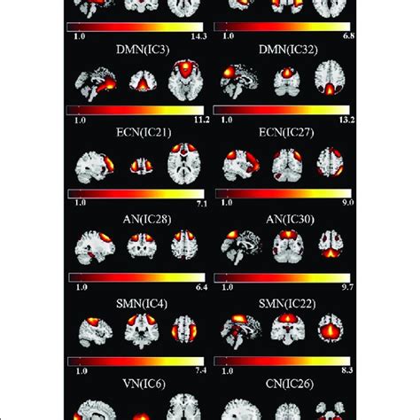 Functional Relevant Resting State Networks Rsns The Spatial Maps