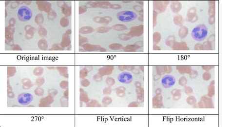 Augmented Images Through Rotation And Flipping Transformation Download Scientific Diagram