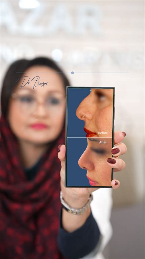 ‎دکتر پرستو بی‌آزار گوش و حلق و بینی، جراحی زیبایی صورت‎ Dr