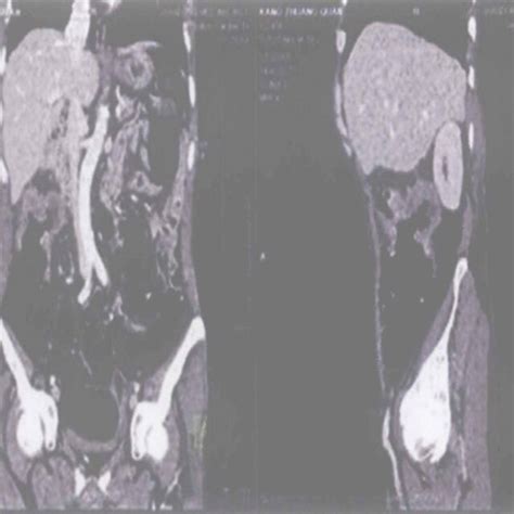 Scanned Image Of Ct Reconstruction Image After Enhancement Download Scanned Image Of Ct Reconstruction Image After Enhancement Download