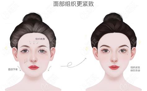 杭州整形医院排名前十位杭州排名前3和排名前1的整形医院尤其出名 美佳社区