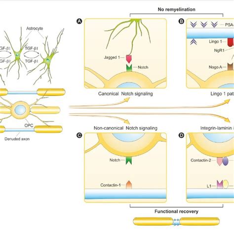 Hypothetical Outcomes For Demyelinated Axon Denuded Axon Impermissive