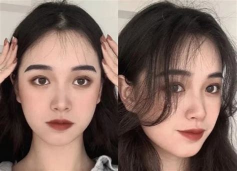 头发细软脱发可以恢复吗 哔哩哔哩