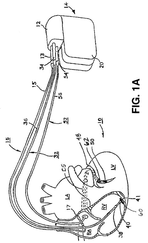 Left Ventricular Size Patented Technology Retrieval Search Results Eureka Patsnap