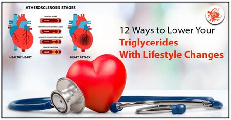 Ways To Lower Your Triglycerides With Lifestyle Changes