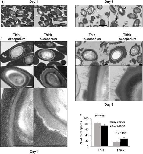 Clostridium Difficile Spore Stain
