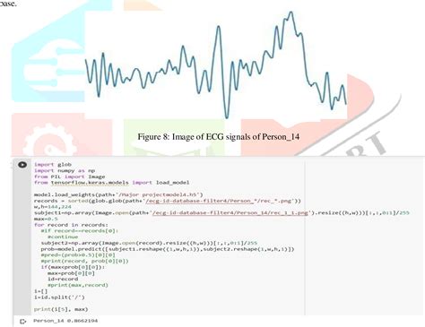 Figure 8 From Identification Of User Using Ecg Signals Semantic Scholar