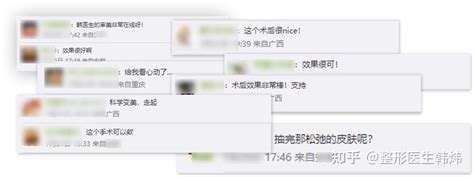 脂肪医生韩炜：腰腹环吸可以改善皮肤松弛吗？ 知乎