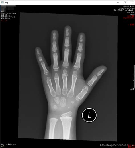 Opencv——图像轮廓2ntourarealittlec的博客 Csdn博客