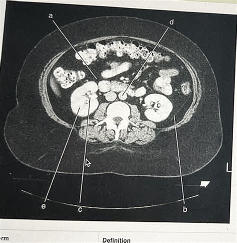 Chapter 7 Quiz Image 2 Diagram Quizlet