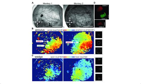 Virus Injections Based On Retinotopy Maps Obtained Using In Vivo Download Scientific Diagram