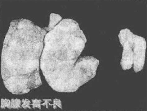 第一节 内分泌代谢系统器官功能及衰老改变 中西医 医学