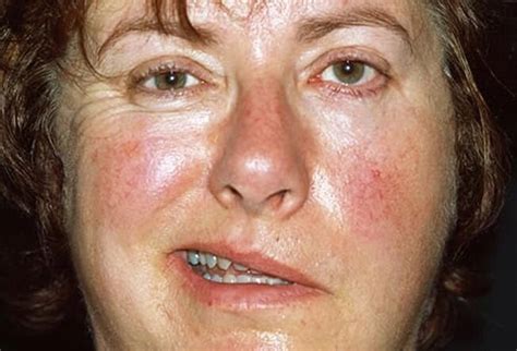 صورت ما در مورد بیماری‌ها چه می‌گوید؟عکس