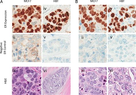 Cell Line Xenograft Experiments At Nettie Connie Blog