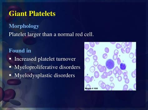 Ppt Wbcs And Plt Abnormal Morphology Powerpoint Presentation Id 6378150