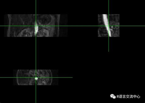 R语言实现DICOM文件的操作 腾讯云开发者社区 腾讯云