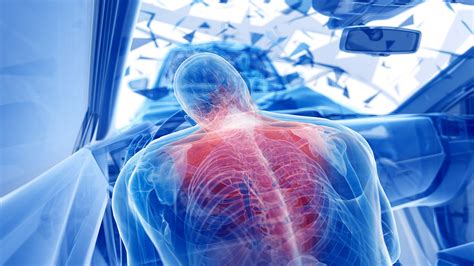 Neck And Back Pain After Car Accident