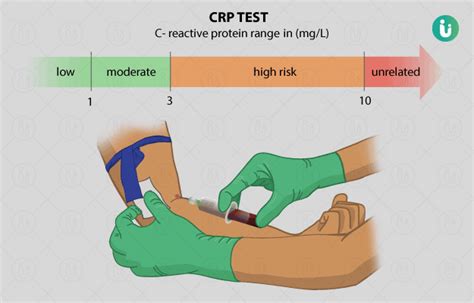 Crp C Reactive Protein Test Procedure Purpose Results Cost Price