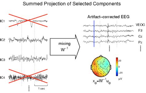 eeg artifact removal with blind source separation