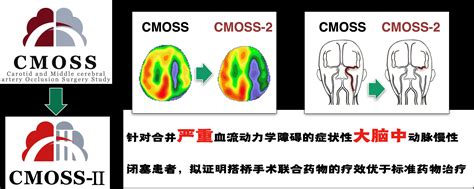 Jama：颅内外血管搭桥手术有了中国证据—新闻—科学网