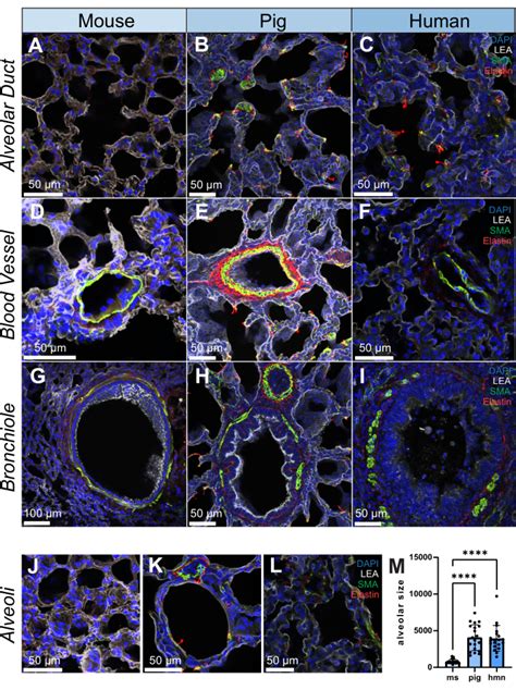 Automated Vibratome Sectioning Of Agarose Embedded Lung Tissue For Multiplex Fluorescence