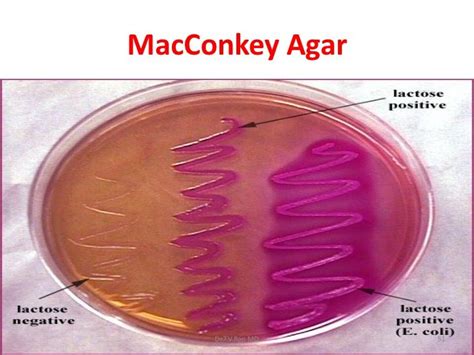 Macconkey Agar Tm Media Microbiology Medical Laboratory Science Medical Laboratory