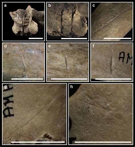 Perimortem Cut Marks On Postcranial Bones Detailed Description In S2