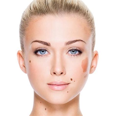 Pregled Mladeža Dermatolog Dermatologija Ordinacija Beoderma Beograd