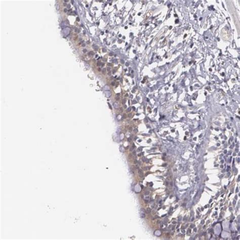Alpha 1 Microglobulin Antibody Novus Biologicals Antibodies Primary