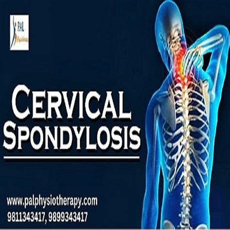 Stream Cervical Spondylosis Treatment In Gurgaon By Pal Physiotherapy Listen Online For Free