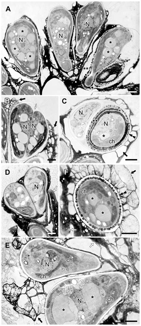 Ac Treatment With N Hexane For 15 Min D Treatment With Cellulase Rs