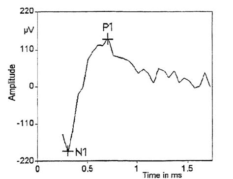 A Normal Evoked Compound Action Potential Waveform Download Scientific Diagram