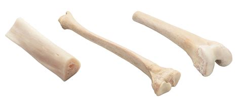 Reconstructive Bone Allosource