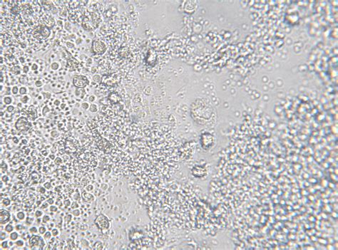 Questions With Answers In PBMC ISOLATION Science Topic