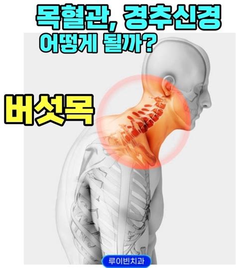 네이버 인플루언서