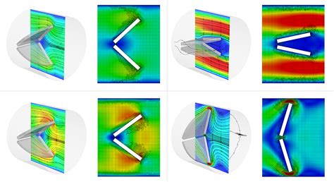 Capturing Heart Valve Dynamics With Implicit Fluid Structure Interaction Modeling Converge Cfd