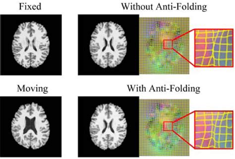 Figure 14 From Difficulty Aware Hierarchical Convolutional Neural Networks For Deformable