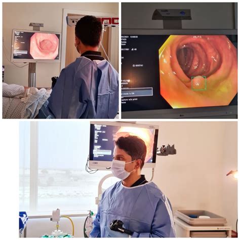 Dr Shareef Tholoor On Linkedin Ai Artificialintelligence Machinelearning Olympus Giendoscopy