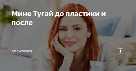 Мине Тугай до пластики и после 300 ЭКСПЕРТОВ Дзен