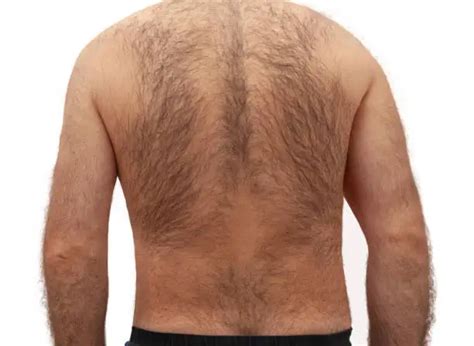 Hairy Butt Pictures Download Free Images On Unsplash